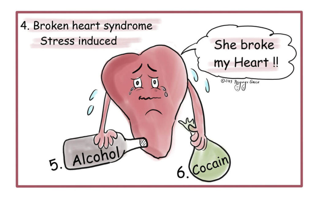 Dilated Cardiomyopathy most common cause - Creative Med Doses